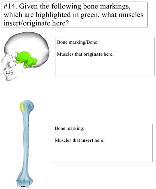 SOLVED: #14.Given the following bone markings which are highlighted in ...