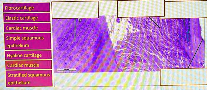 SOLVED: Can someone help label this? Fibrocartilage Elastic cartilage ...