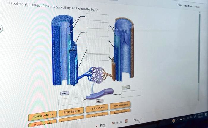 SOLVED: Label the structures of the artery.capillary,and vein in the ...