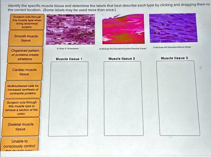Identify the specific muscle tissue and determine the labels that best ...