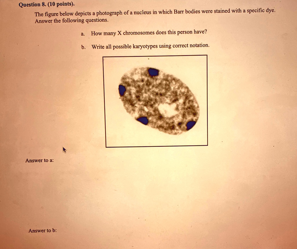 question 8 10 points the figure below depicts a photograph of a nucleus ...