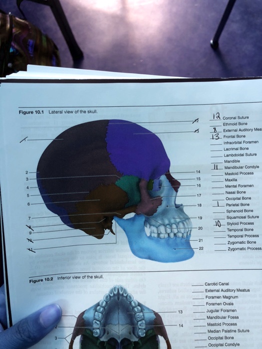 SOLVED: Figure 10.1 Lateral view of the skull. 1a Coronal Suture ...