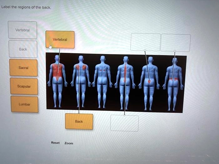 Label the regions of the back. Vertebral Vertebral Back Sacral Scapular ...