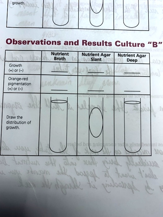 Observations and Results Culture "B Nutrient Nutrient Agar Nutrient ...