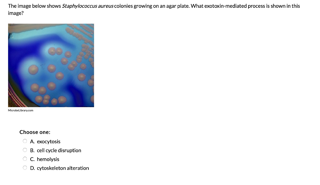 SOLVED: The image below shows Staphylococcus aureus colonies growing on ...