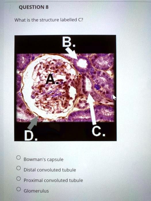 SOLVED: What is the structure labelled C? B C O Bowman's capsule O Distal convoluted tubule O ...