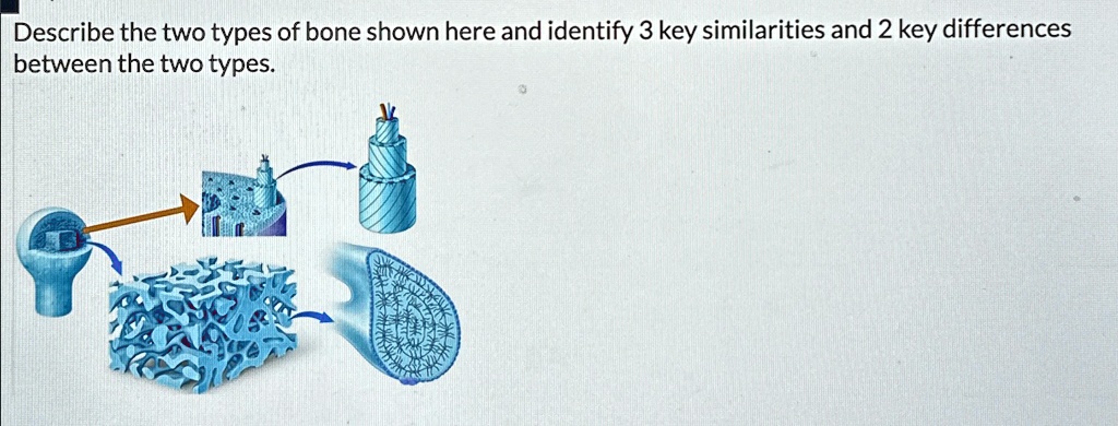 Describe the two types of bone shown here and identify 3 key ...
