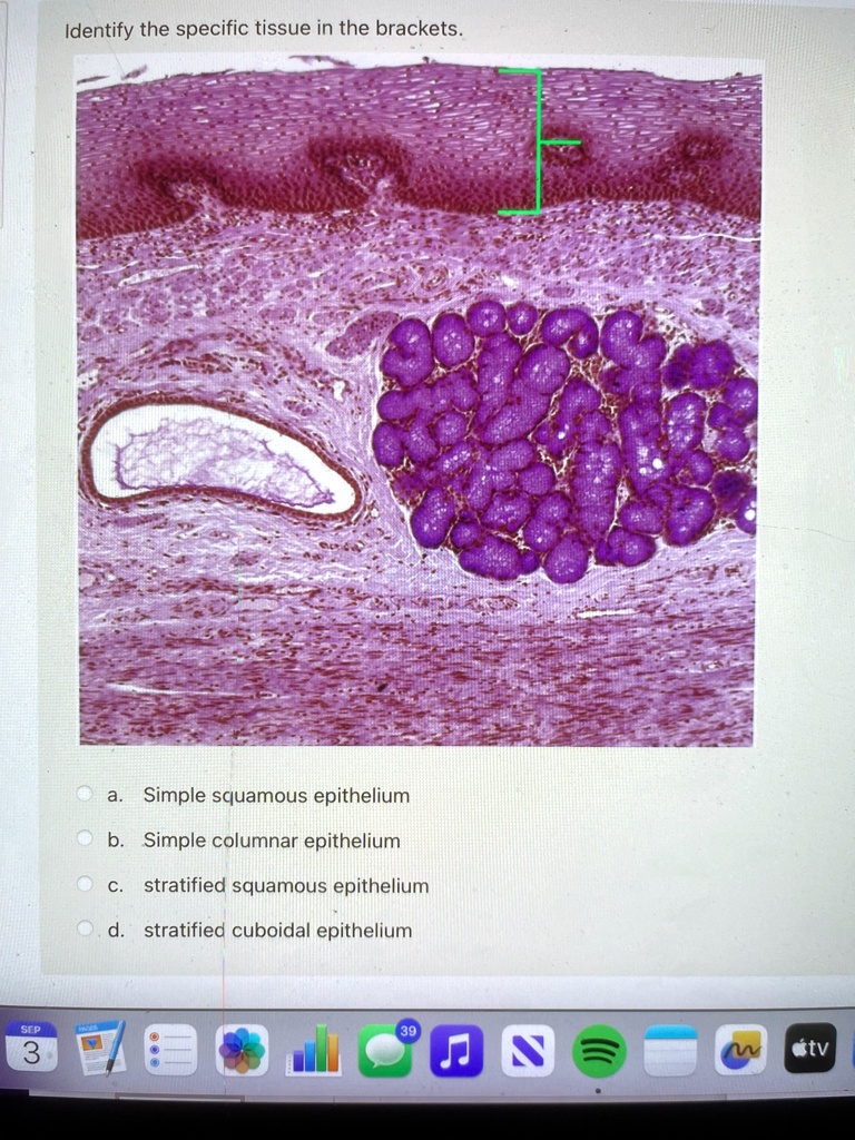 Identify the specific tissue in the brackets. a. Simple squamous ...