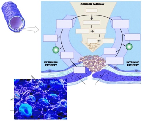 SOLVED: COMMON PATHWAY EXTRINSIC PATHWAY INTRINSIC PATHWAY