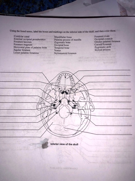 Solved Condylar Canal External Occipital Protuberance Foramen Lacerum Foramen Magnum Horizontal