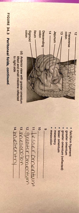 12 Transverse colon 13 Jejunum 14 Descending colon Ileum Si...