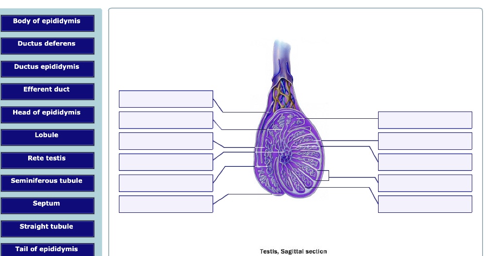 SOLVED: Body of epididymis Ductus deferens Ductus epididymis Efferent ...