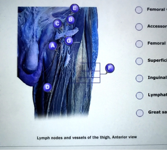 SOLVED: Femoral Accessor Femoral Superficial Inguinal Lymphatic Great saphenous Lymph nodes and ...