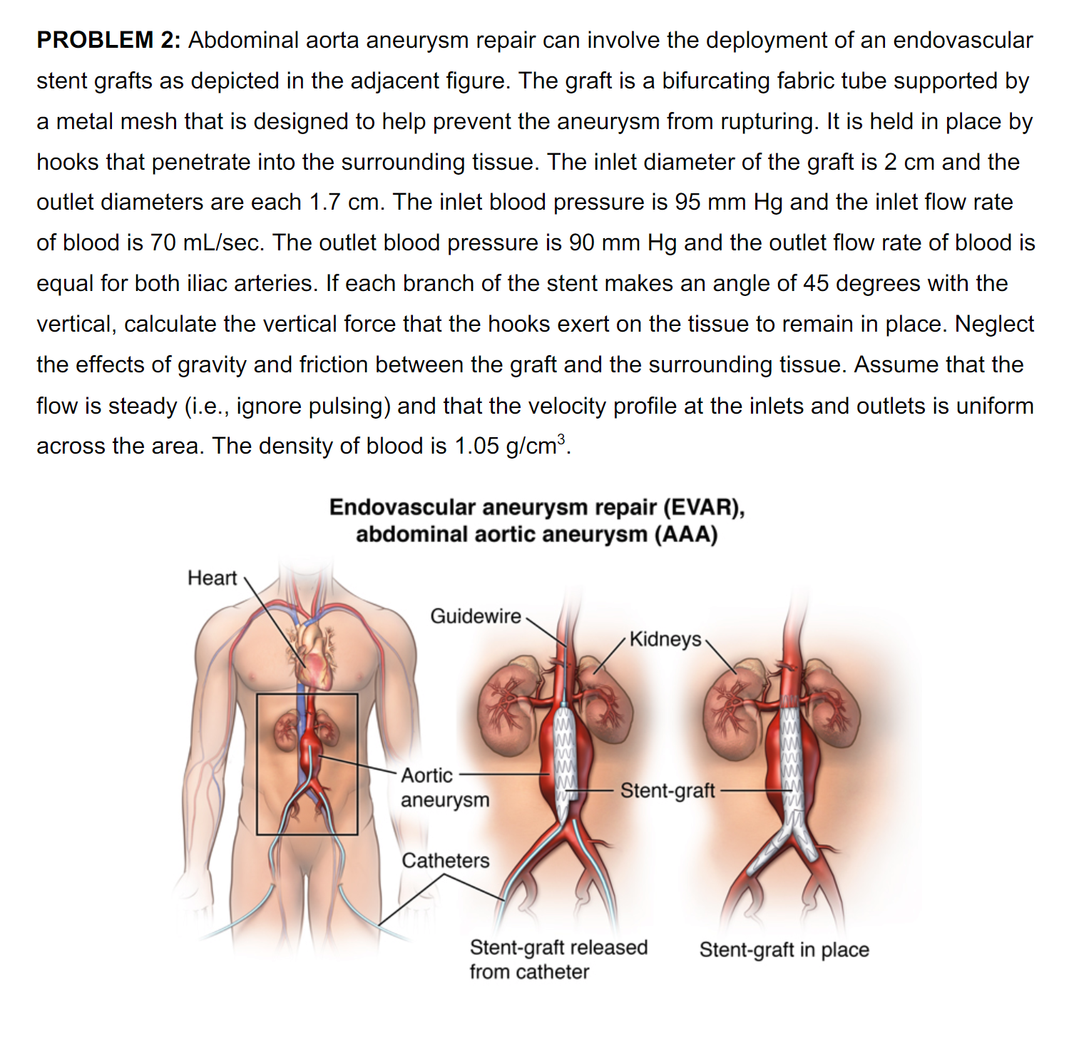 PROBLEM 2: Abdominal aorta aneurysm repair can involve the deployment of an endovascular stent ...
