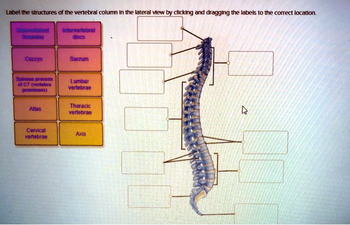 Label the structures of the vertebral column in the lateral view by clicking and dragging the ...