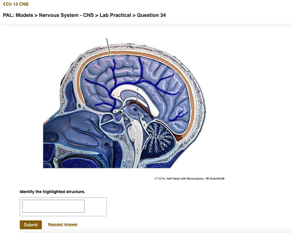 pal models nervous system cns lab practical question 34 ch13 cns pal ... pal models nervous system cns lab practical question 34 ch13 cns pal ...