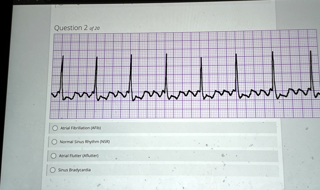 Question 2 Of 20 Atrial Fibrillation Afib Normal Sinus Rhythm Nsr