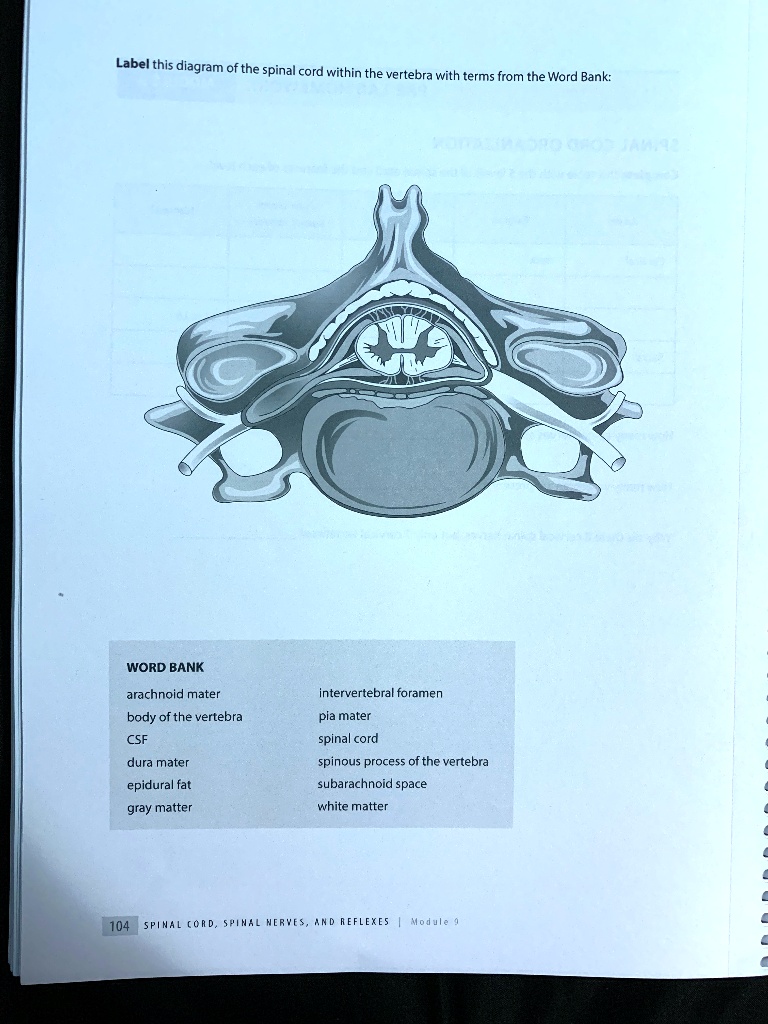SOLVED: LABEL AND COLOR PLEASE WORD BANK arachnoid mater body of the ...