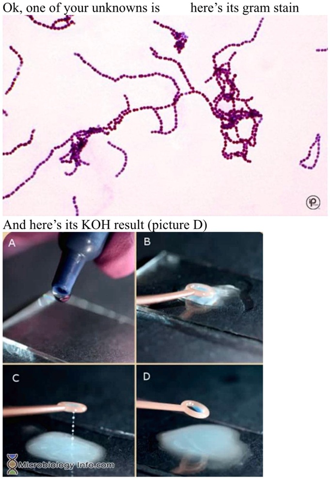 ok one of your unknowns is heres its gram stain and heres its koh ...
