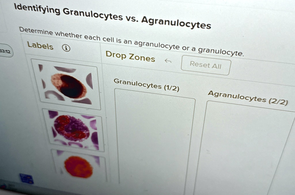 identifying granulocytes vs agranulocytes determine whether each cell ...