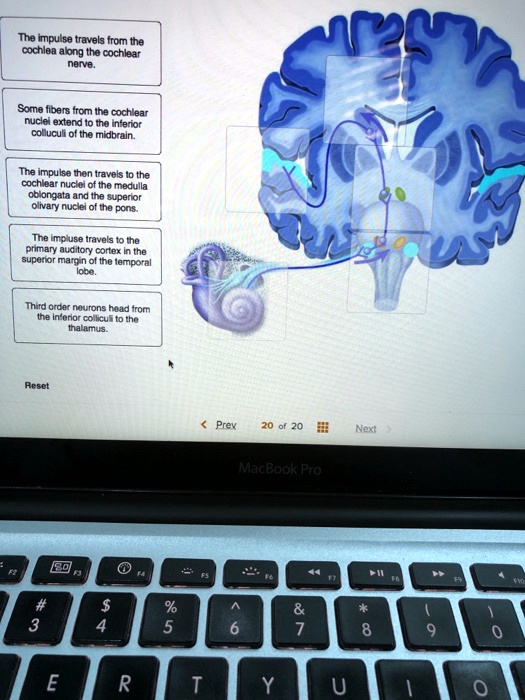 SOLVED: The impulse travels from the cochlea along the cochlear nerve ...