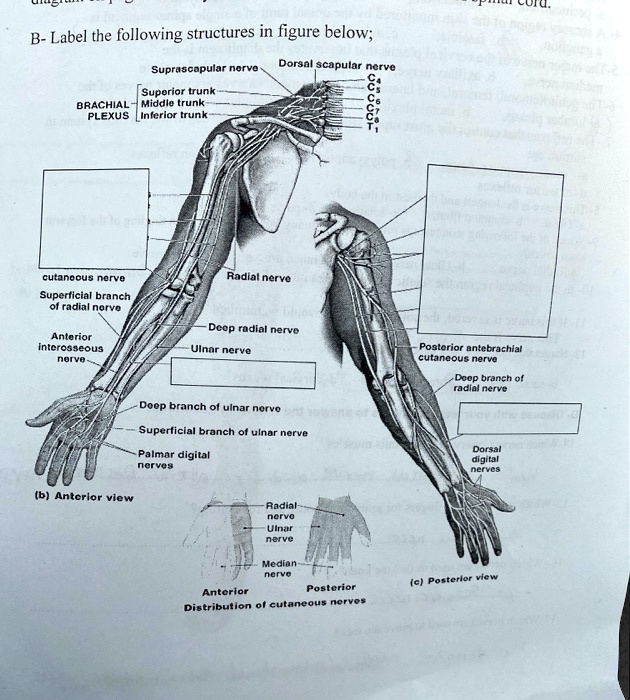 SOLVED: B- Label the following structures in the figure below ...