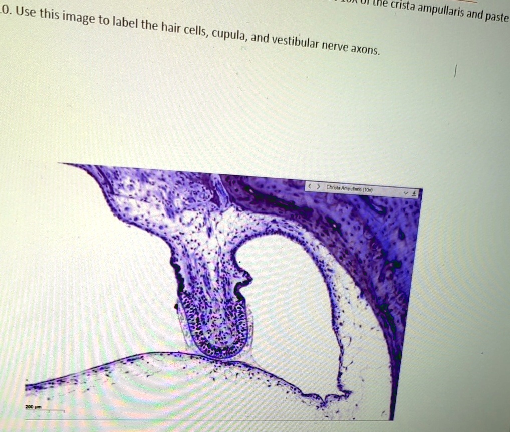 The crista ampullaris and paste 0. Use this image to label the hair ...