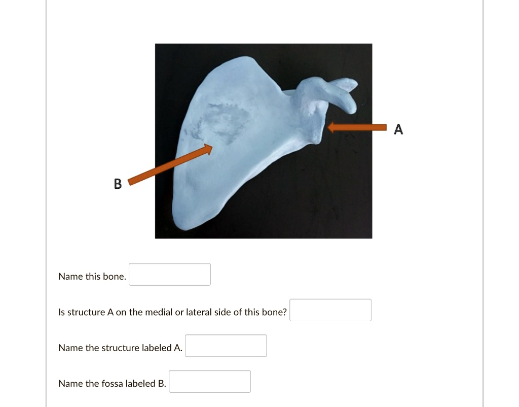 SOLVED: A B Name this bone. Is structure A on the medial or lateral side of this bone? Name the ...