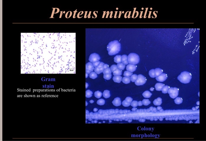 SOLVED: Proteus mirabilis Gram stain Stained preparations of bacteria ...