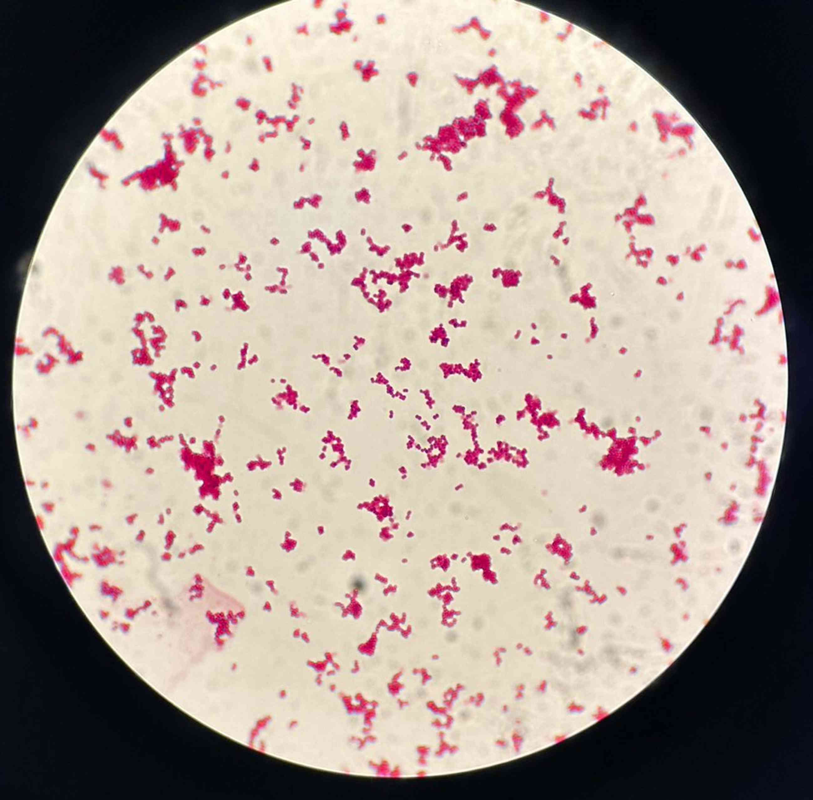 SOLVED: What is the gram reaction and cell shape and arrangement in ...