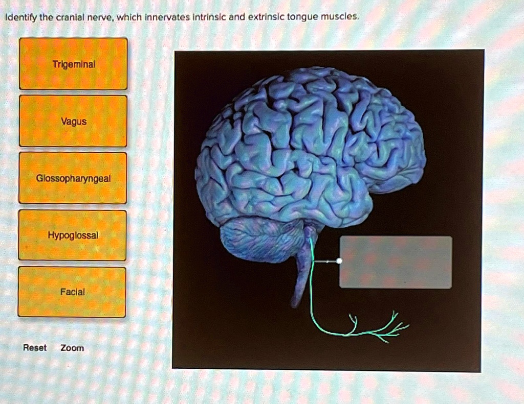 SOLVED: Identify the cranial nerve, which innervates intrinsic and ... SOLVED: Identify the cranial nerve, which innervates intrinsic and ...