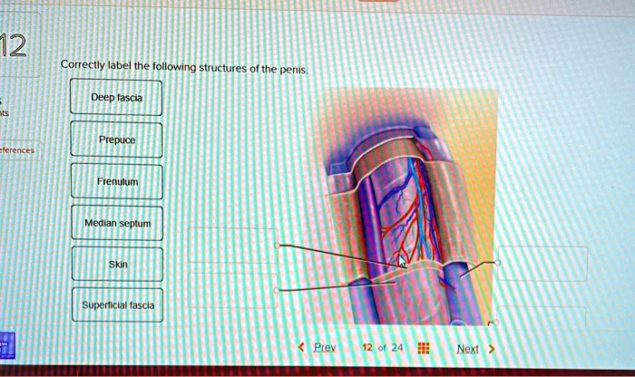 SOLVED: 12. Correctly label the following structures of the penis: - Deep Fascia - Prepuce ...