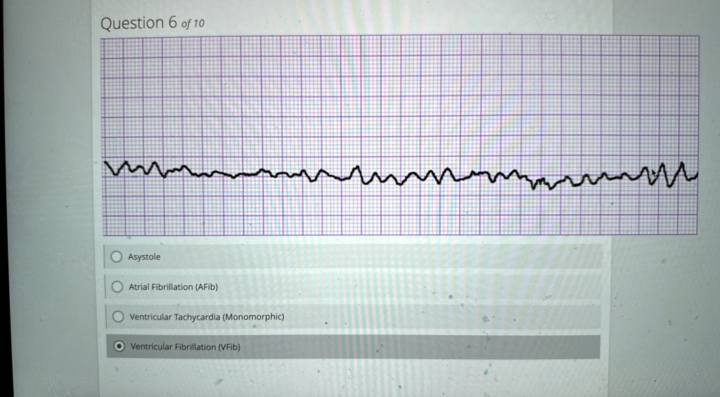 question 6 of 10 asystole atrial fibrillation afib ventricular ...