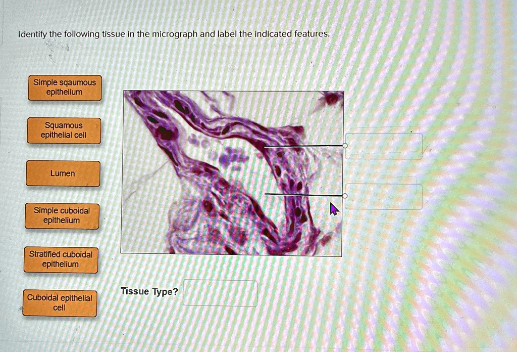 Identify the following tissue in the micrograph and label the indicated features. Simple ...