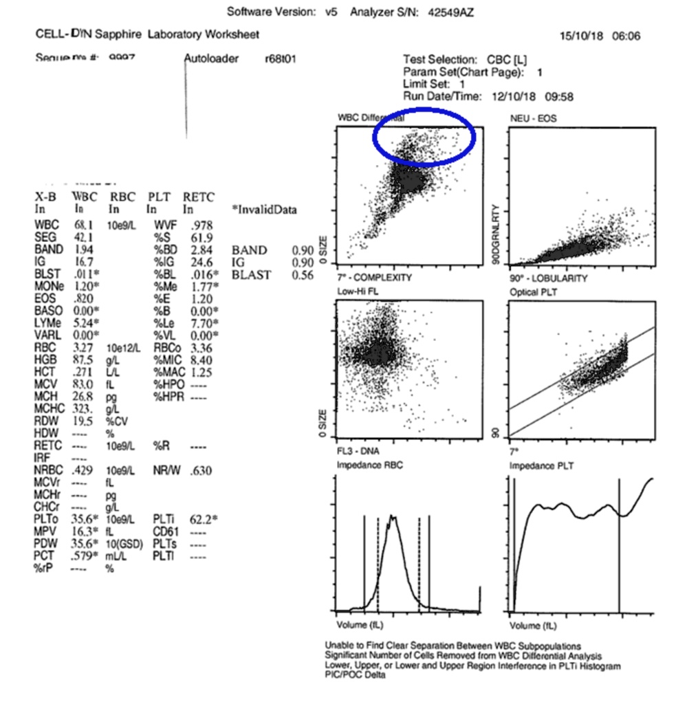 SOLVED: 4a: What is the absolute lymphocyte count for this patient (to ...
