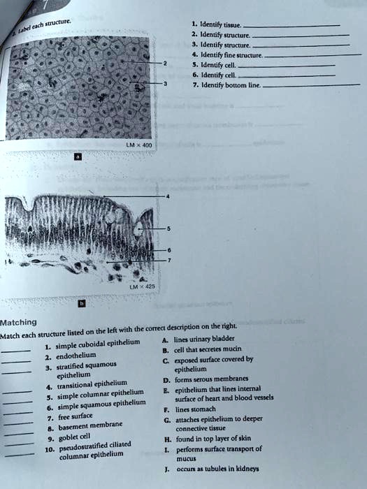 Label each structure. 1. Identify tissue... 2. Identify structure... 3. Identify structure... 4 ...