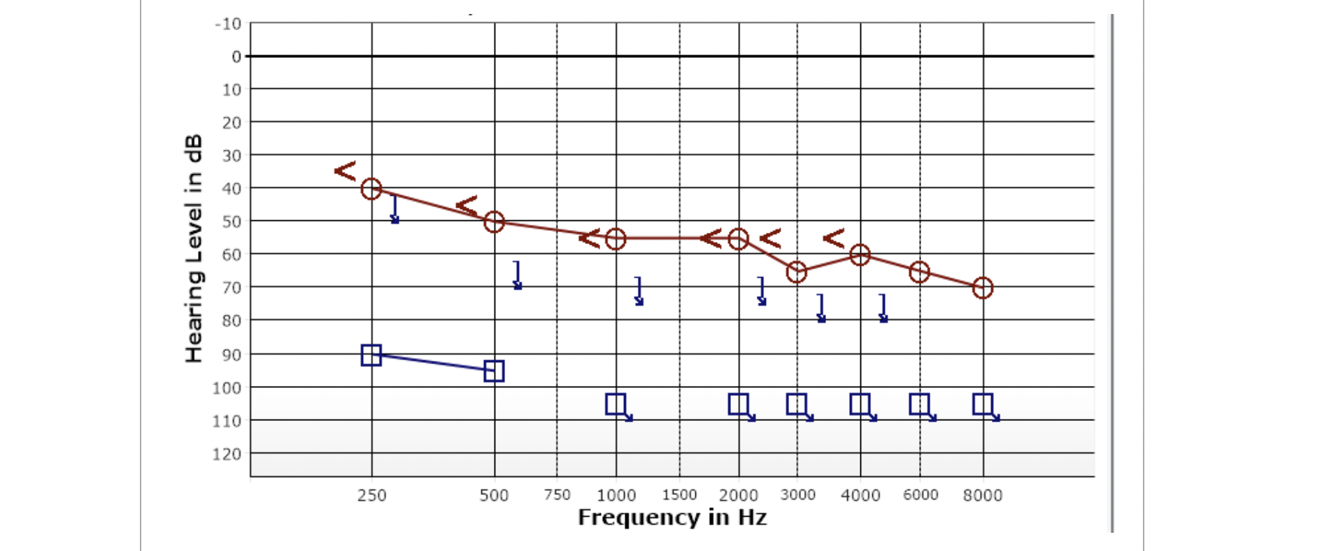 Interpret this adult audiogram. What type and degree of hearing loss is ...
