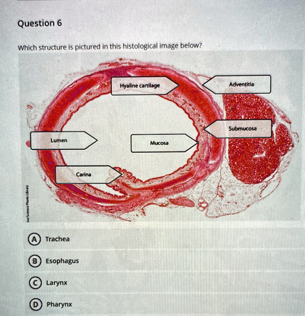 SOLVED: Question 6 Which structure is pictured in this histological ...