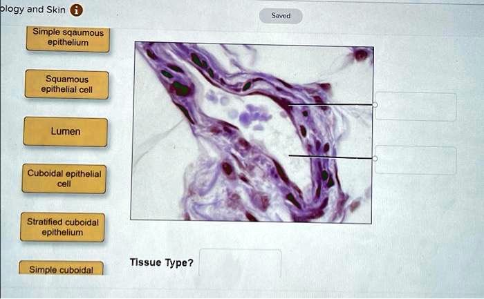 Plogy and Skin Simple squamous epithelium Squamous epithelial cell ...