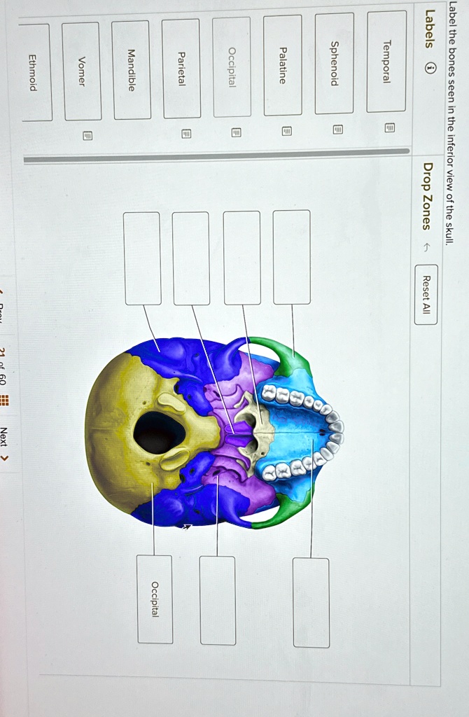 SOLVED: Label the bones seen in the inferior view of the skull. Labels ...