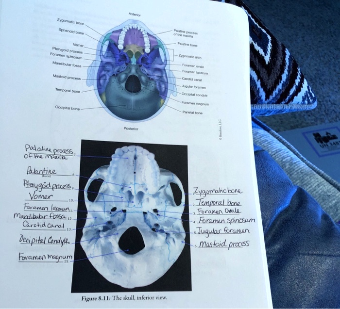 Anterior Zygomatic bone Sphenoid bone Vomer Pterygoid process Foramen ...