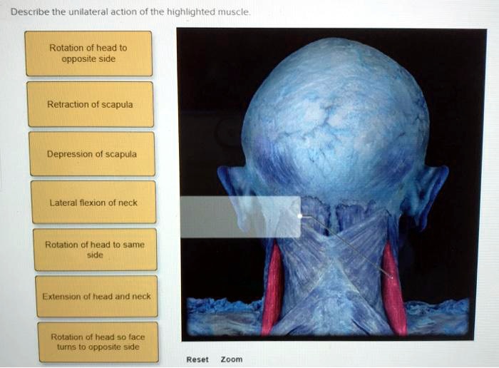 describe the unilateral action of the highlighted muscle rotation of ...