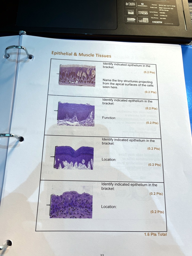 Epithelial Muscle Tissues Identify indicated epithelium in the bracket ...
