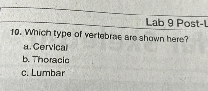 lab 9 post 1 10 which type of vertebrae are shown here a cervical b ...