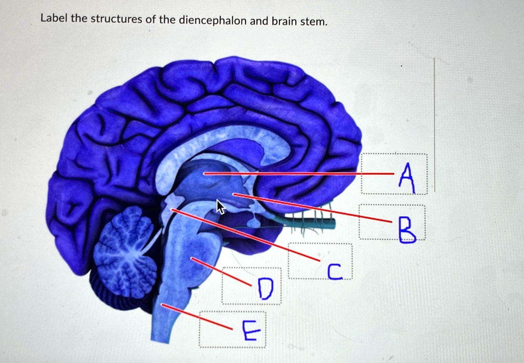 Label the structures of the diencephalon and brain stem.
