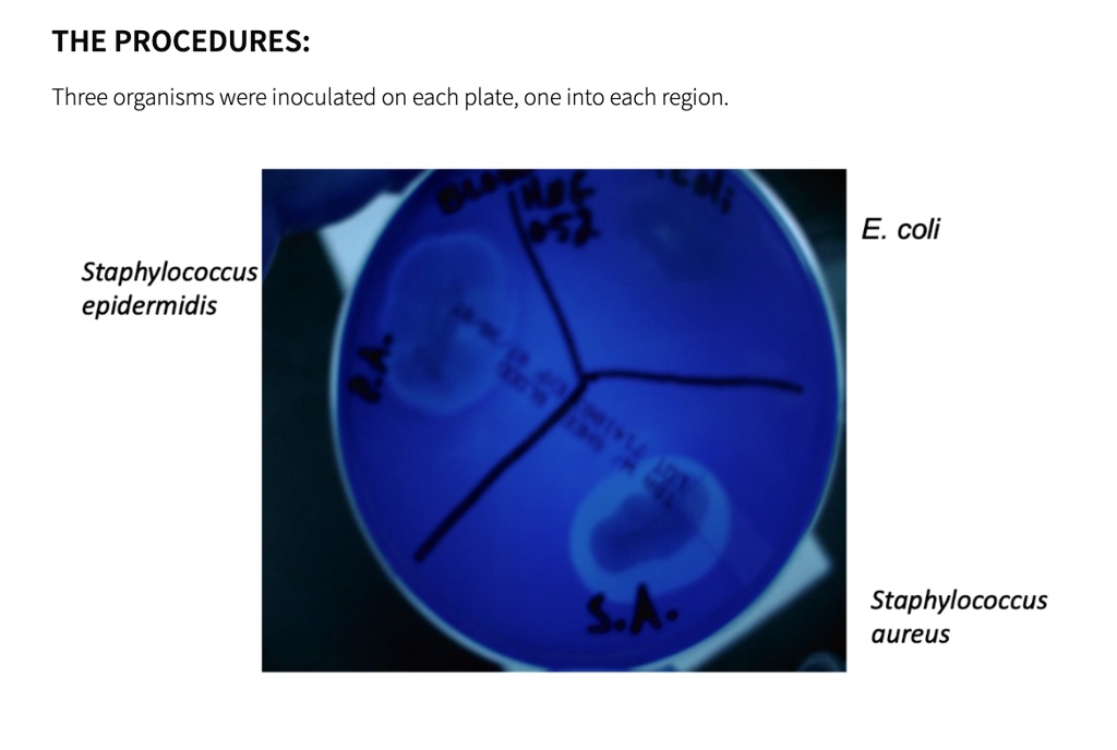 SOLVED: THE PROCEDURES: Three organisms were inoculated on each plate ...