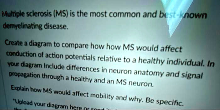 Multiple sclerosis (MS) is the most common and best-known demyelinating ...