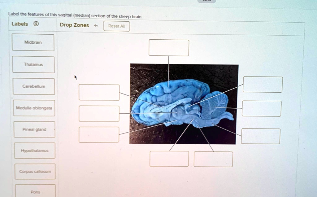 SOLVED: Label the features of this sagittal (median) section of the ...