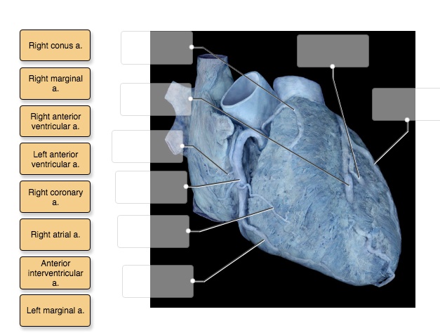 SOLVED: Label the coronary arteries. Right conus a. Right marginal a ...