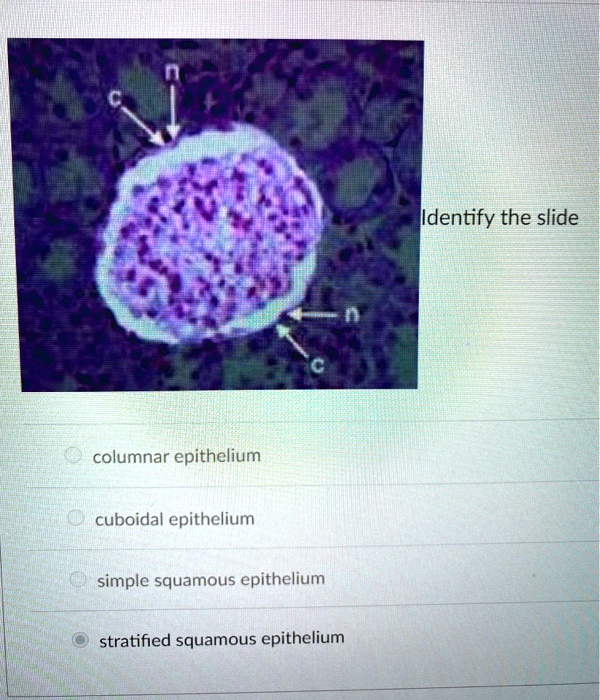 SOLVED:Identify the slide columnar epithelium cuboidal epithelium ...